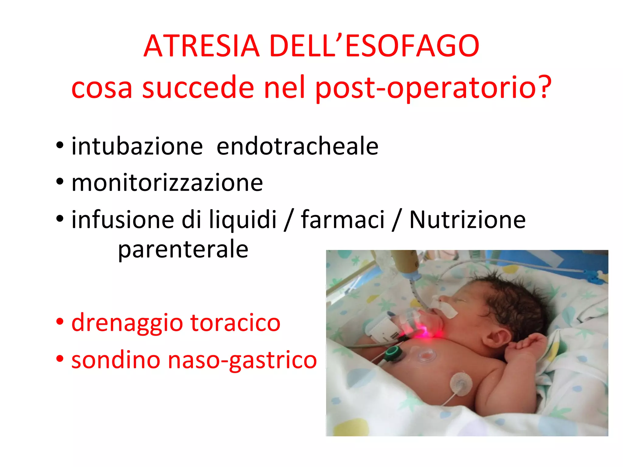 Atresia Esofagea - Cosa succede nel postoperatorio? | PDF