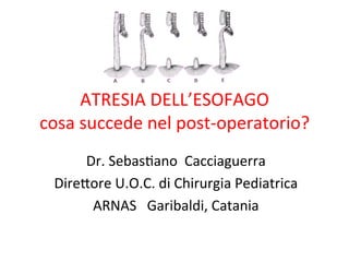 Atresia Esofagea - Cosa succede nel postoperatorio? | PDF