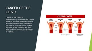 CANCER of Cervix- Easy ppt for Nurses | PDF