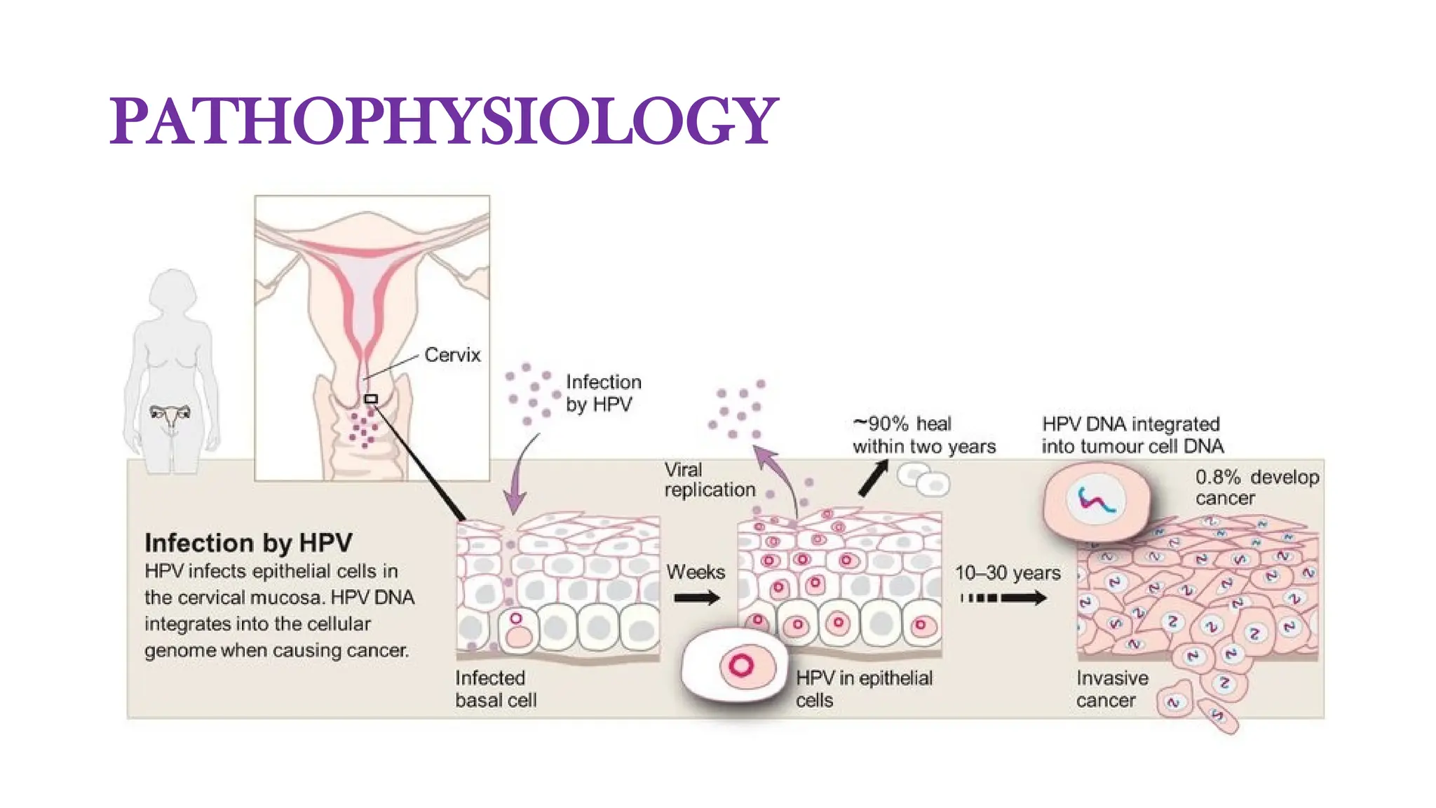 Ca Cervix.pptx ca cervix ca cervix ca cervix | PPTX