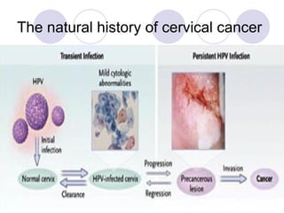 CANCER OF THE CERVIX/ CERVICAL CARCINOMA | PPTX
