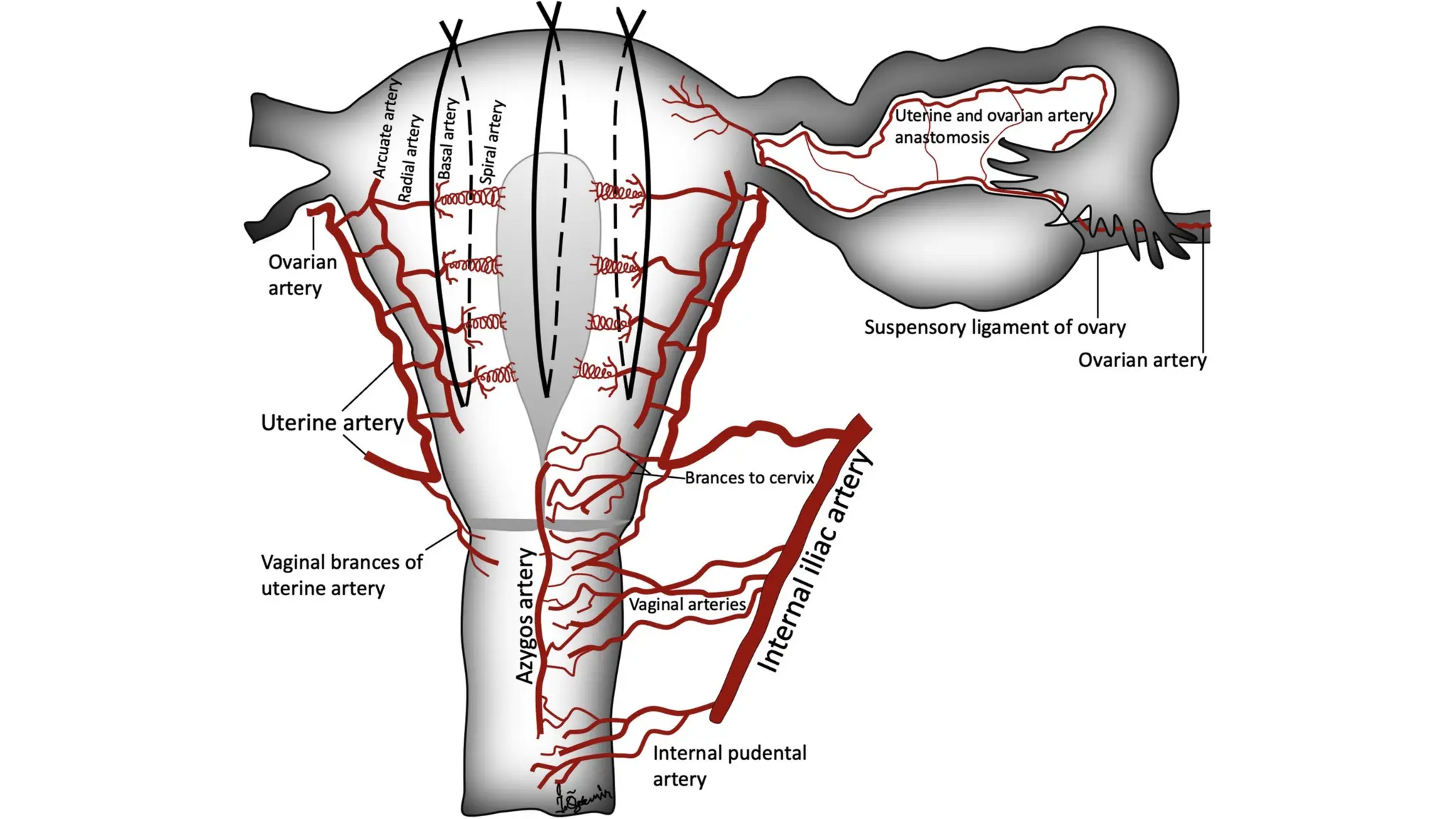 Carcinoma CERVIX - FIGO staging .......Carcinoma cervix Anatomy ...