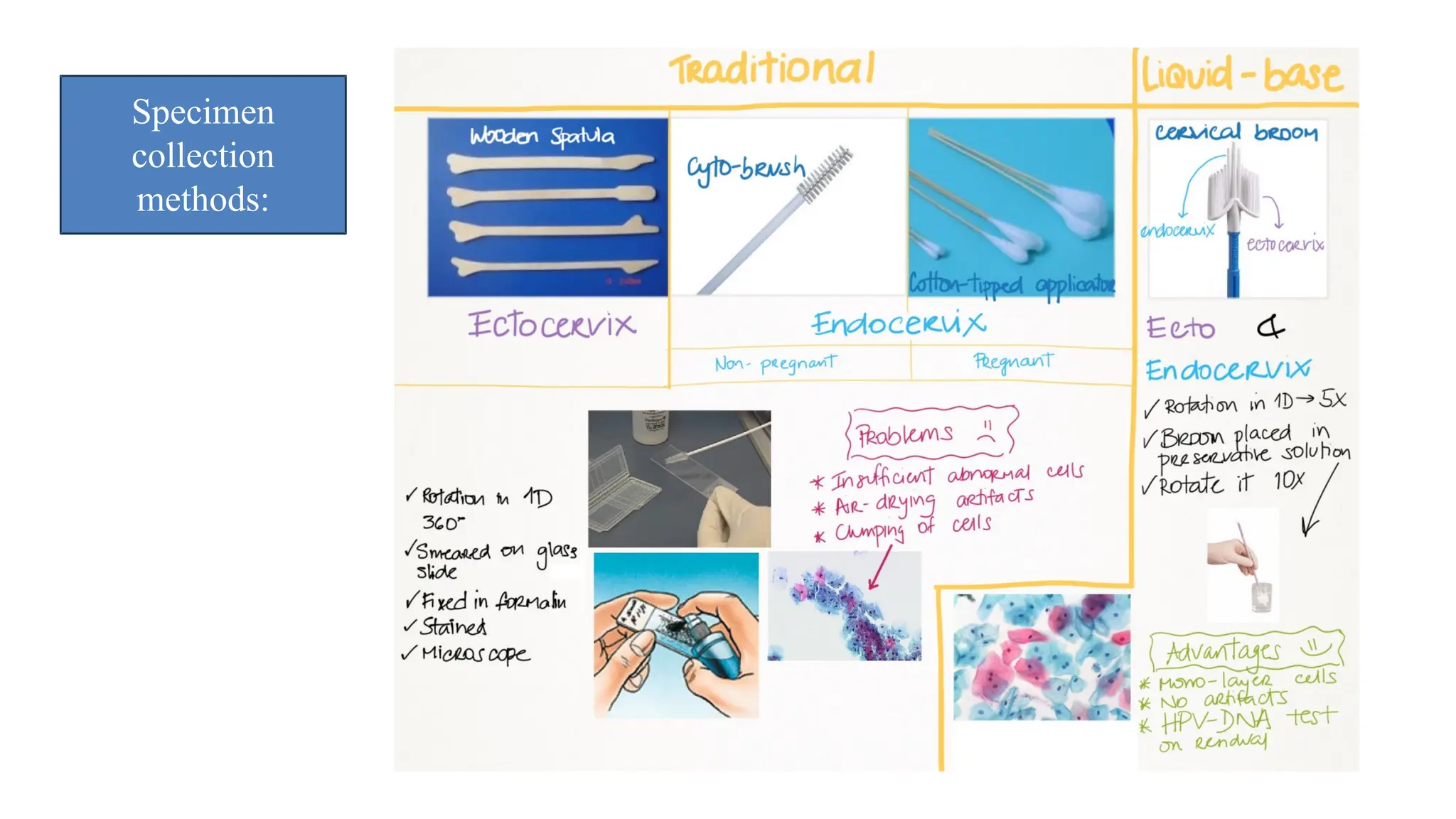 Carcinoma CERVIX - FIGO staging .......Carcinoma cervix Anatomy ...