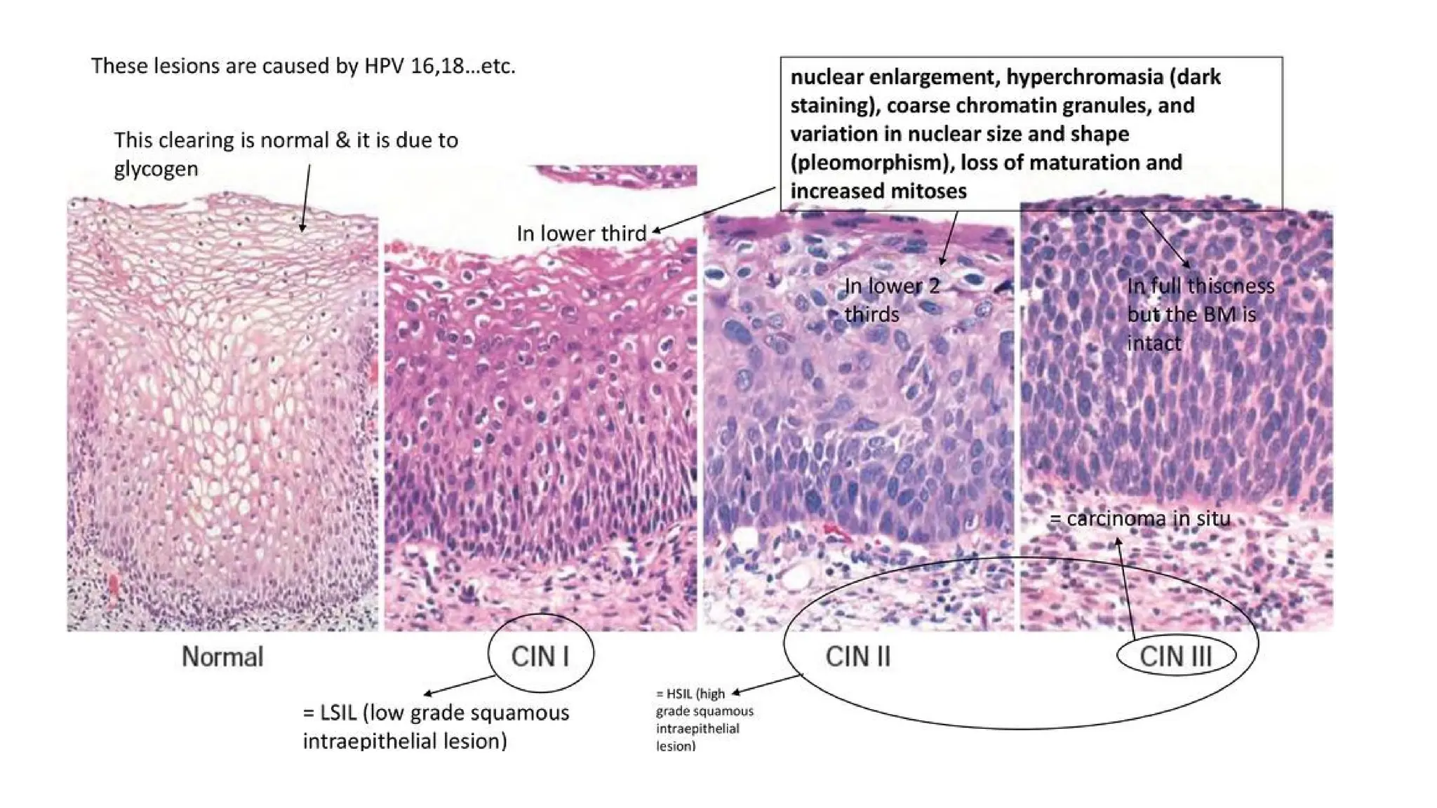 Carcinoma CERVIX - FIGO staging .......Carcinoma cervix Anatomy ...