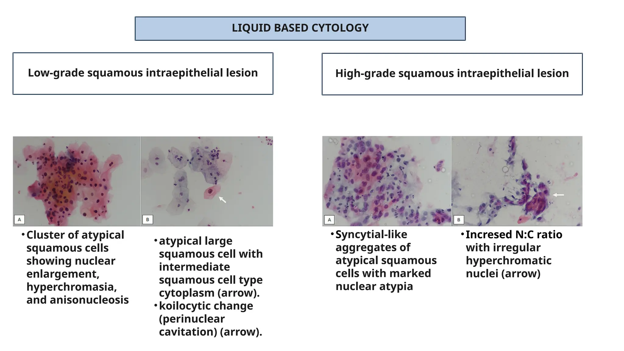Carcinoma CERVIX - FIGO staging .......Carcinoma cervix Anatomy ...