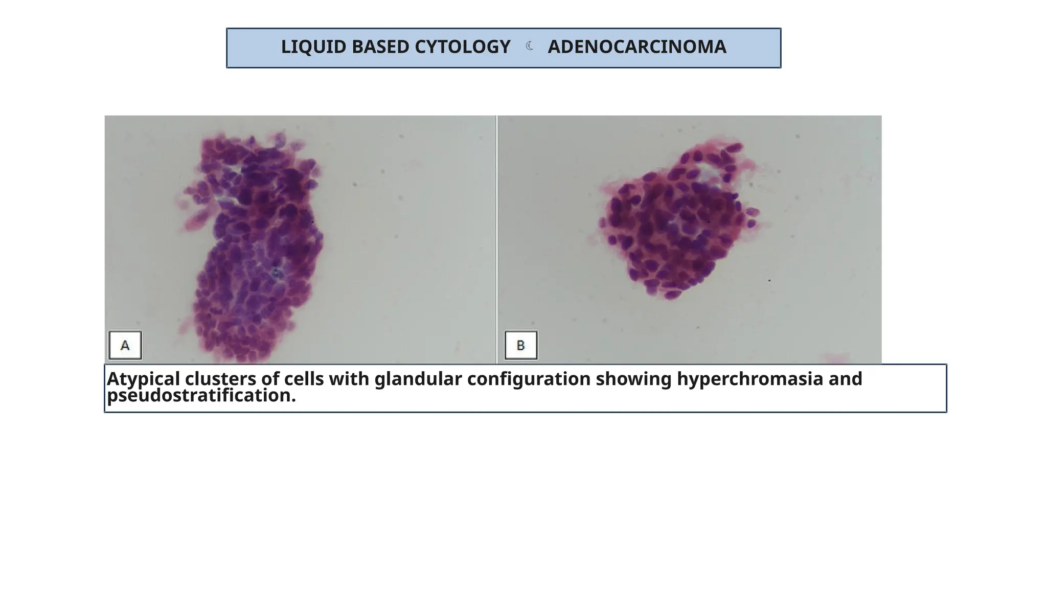 Carcinoma CERVIX - FIGO staging .......Carcinoma cervix Anatomy ...