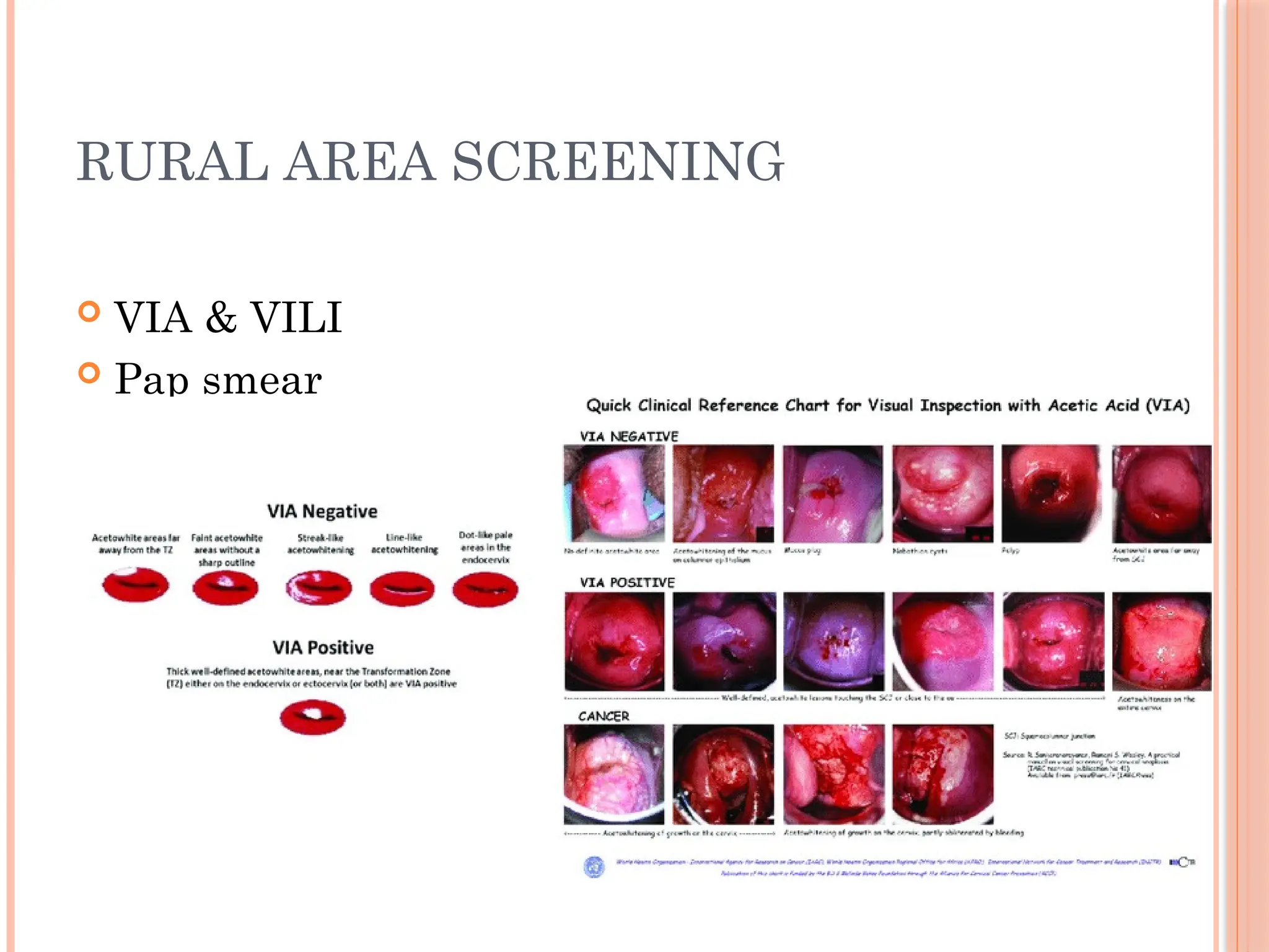 CA CERVIX Anatomy, pathogenesis, clinical features, management, | PPT