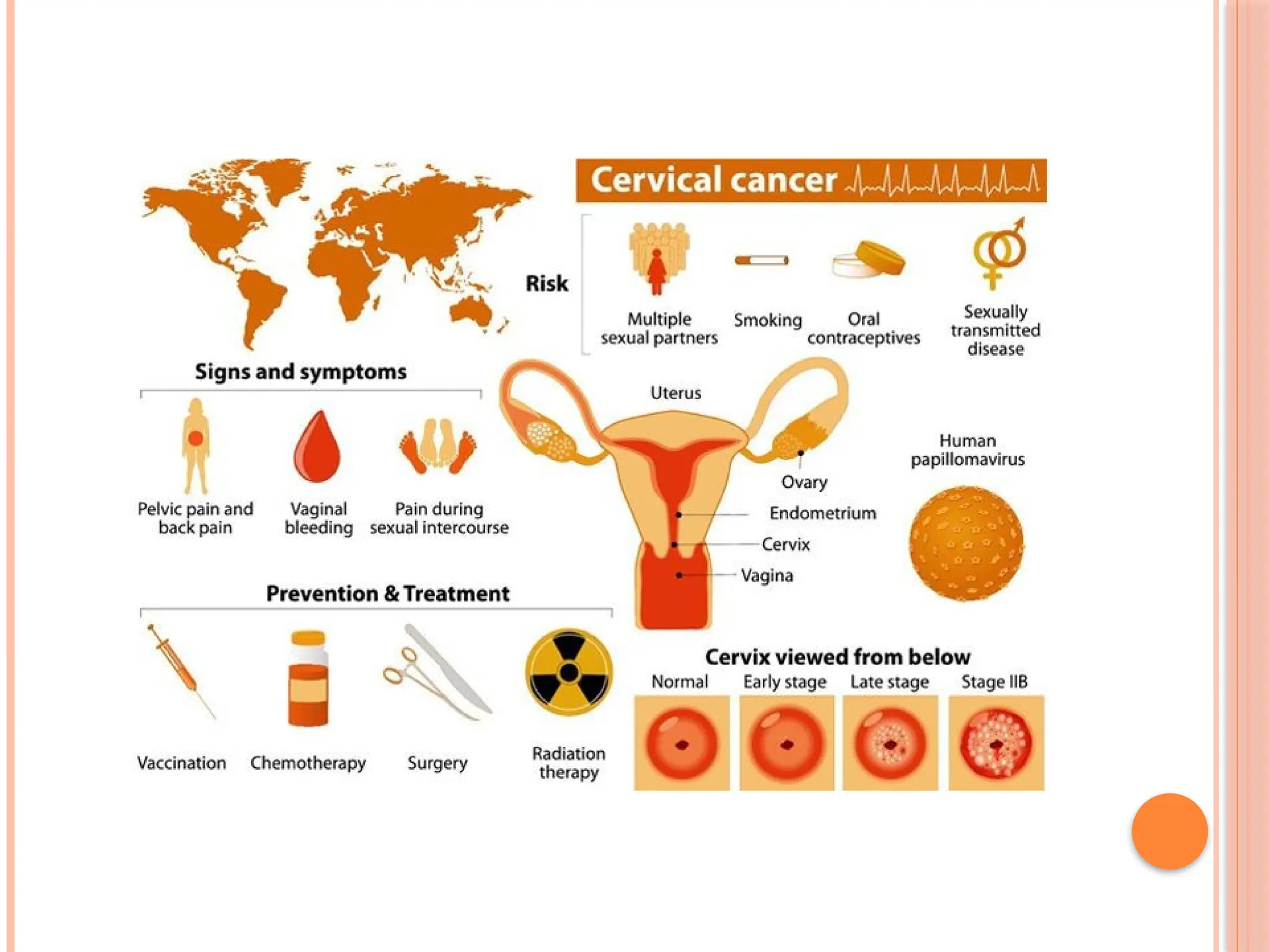 CA CERVIX Anatomy, pathogenesis, clinical features, management, | PPT