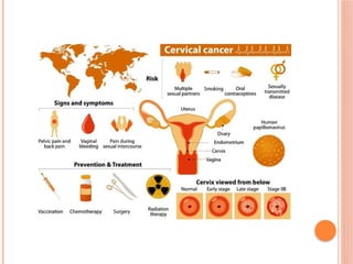 CA CERVIX Anatomy, pathogenesis, clinical features, management, | PPT