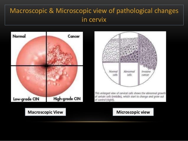 Cervix When Period Is Due