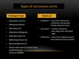 Ca cervix | PDF