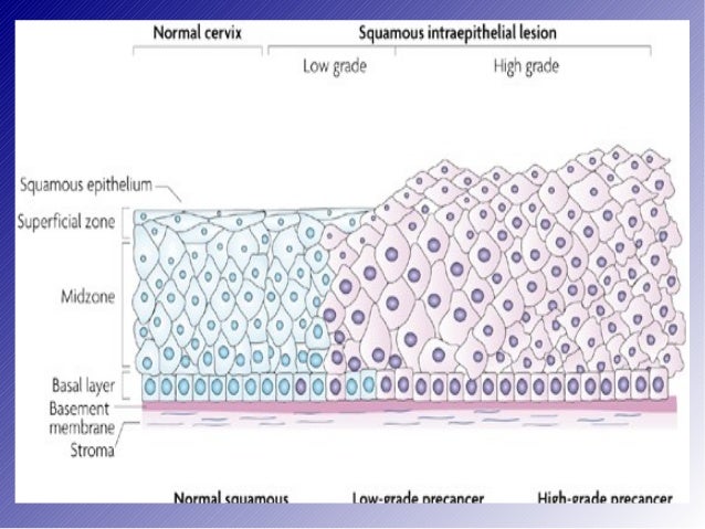 Cervix Transformation Zone Histology