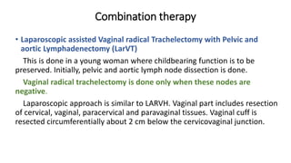 Ca Cervix management options.pptx