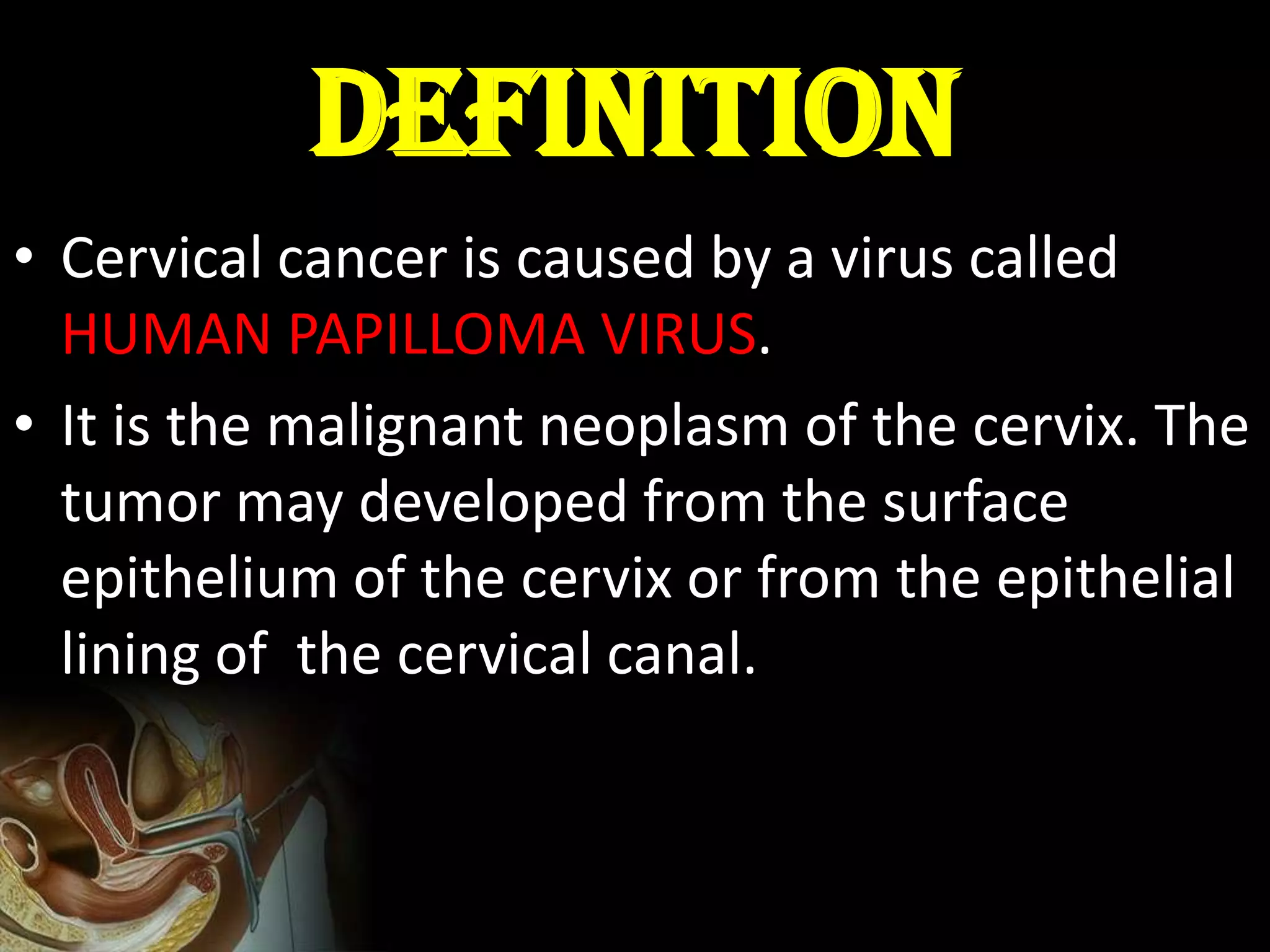 cancer of cervix | PPTX