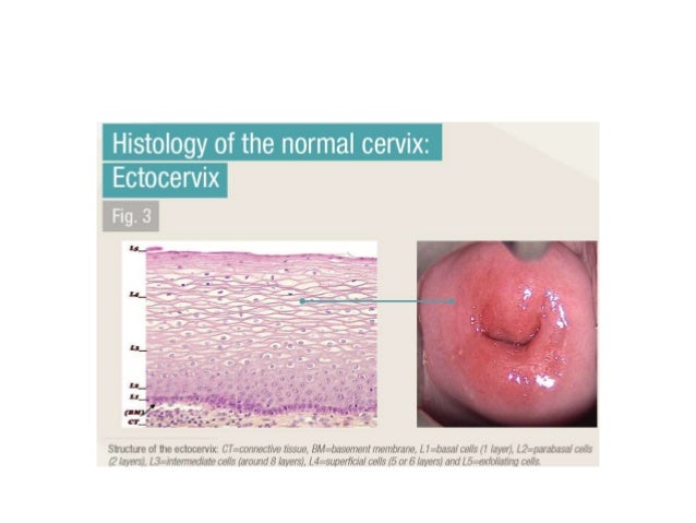 Ca cervix pre managment