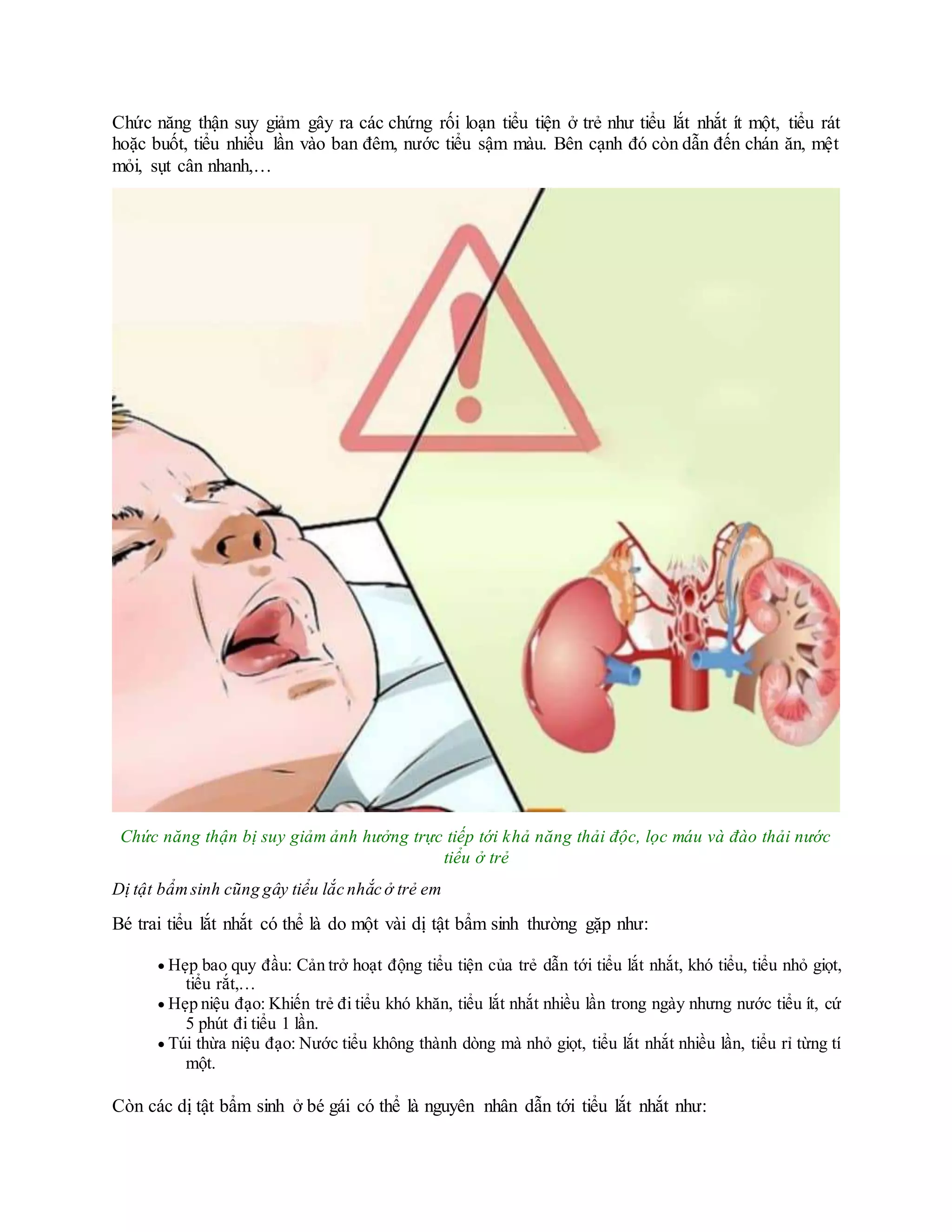 Cach dieu tri tieu lat nhat o tre em.docx