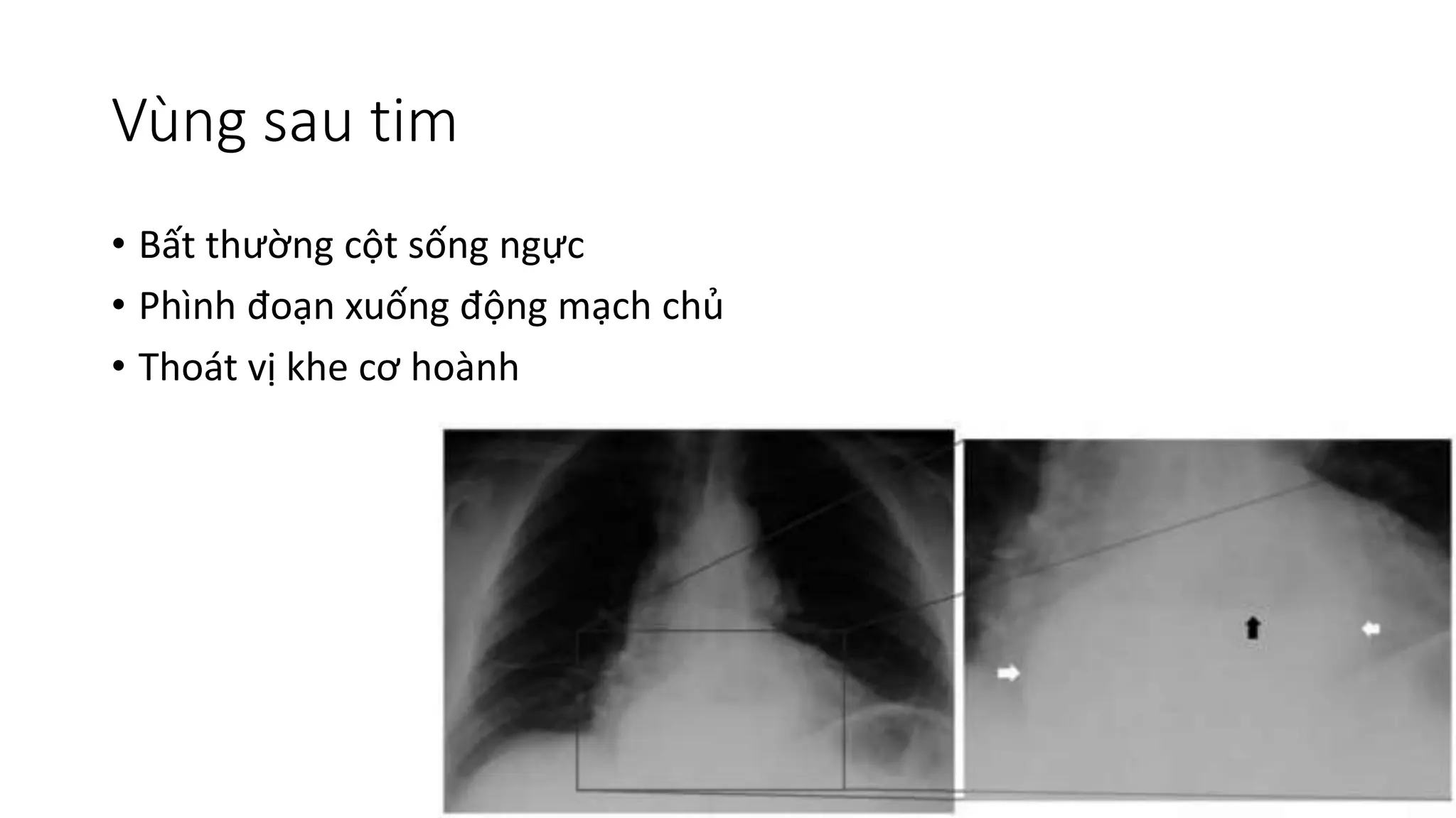 CÁCH ĐỌC X QUANG NGỰC - 25/5/2016.pptx