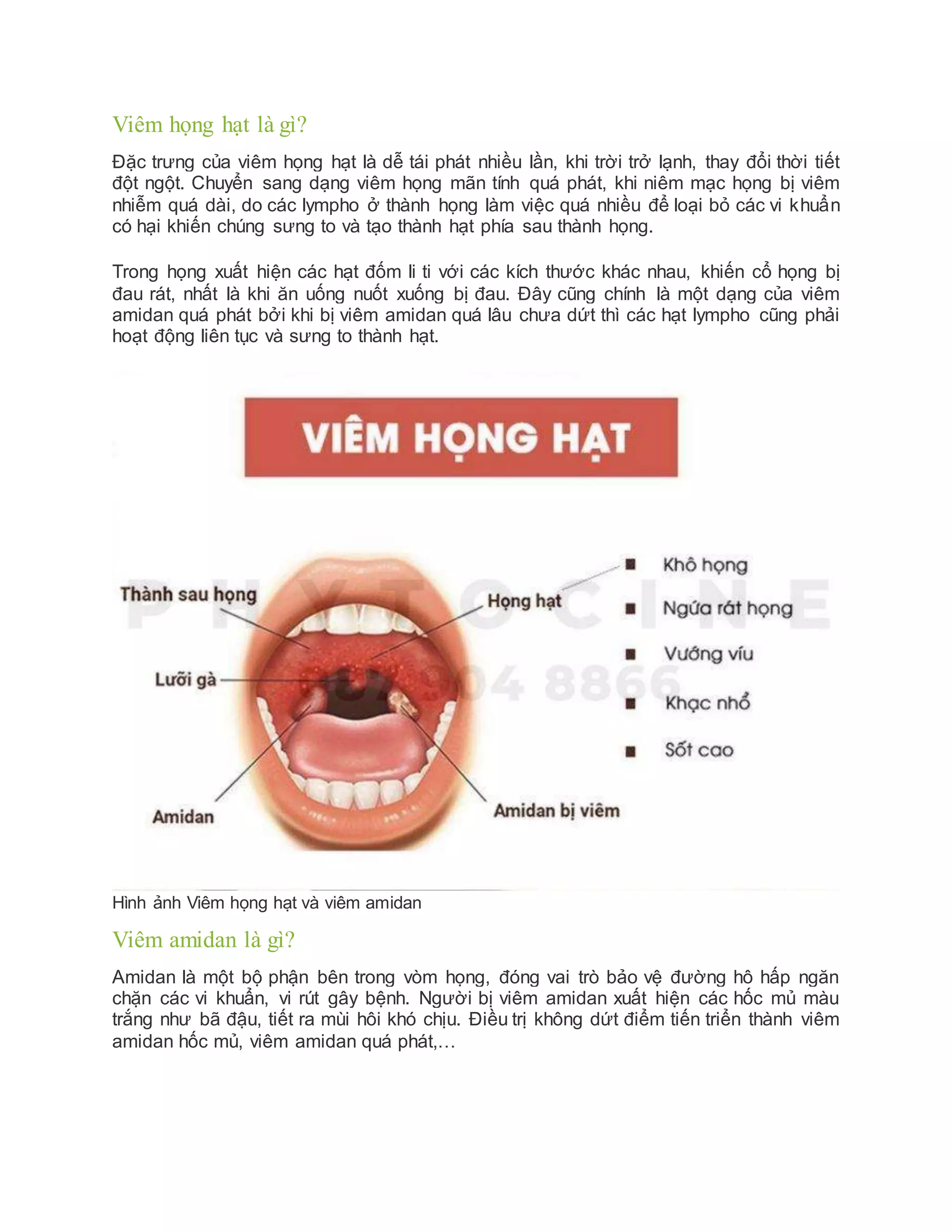 Cach phan biet viem hong hat va viem amidan.docx