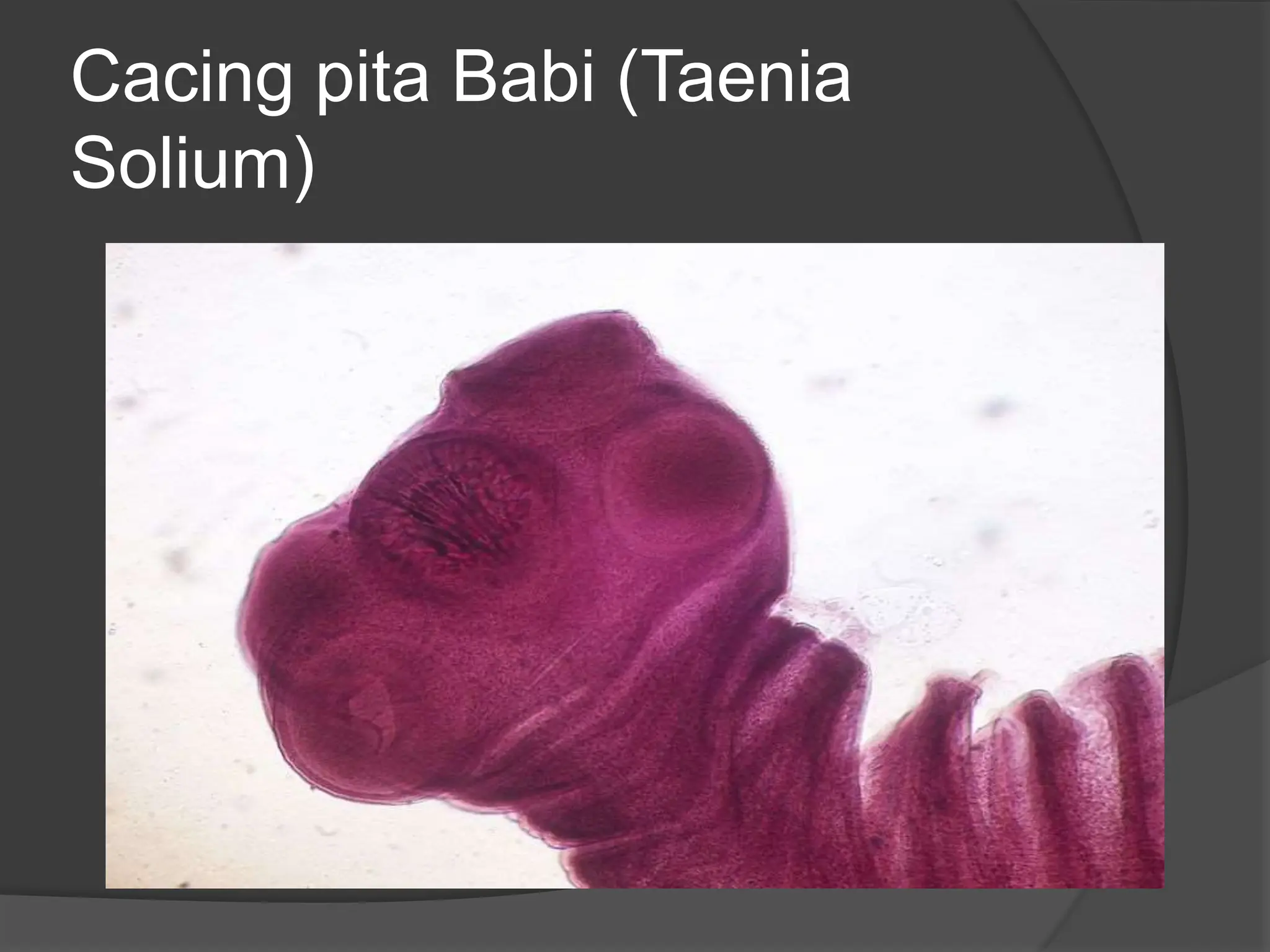 CACING_PITA_PATOFIS bahan materi kuliah b | PPT