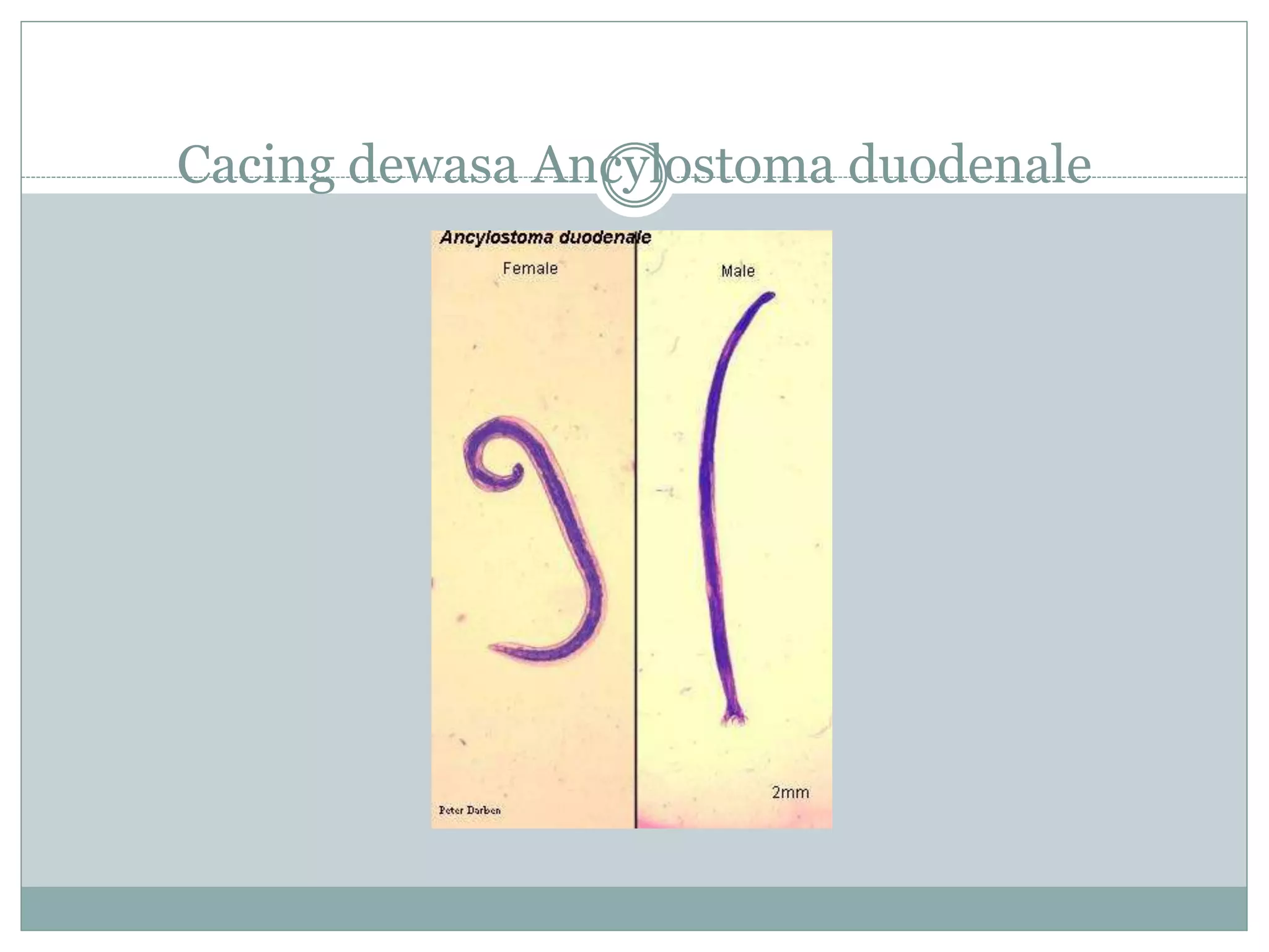 Cacing tambang.pptx