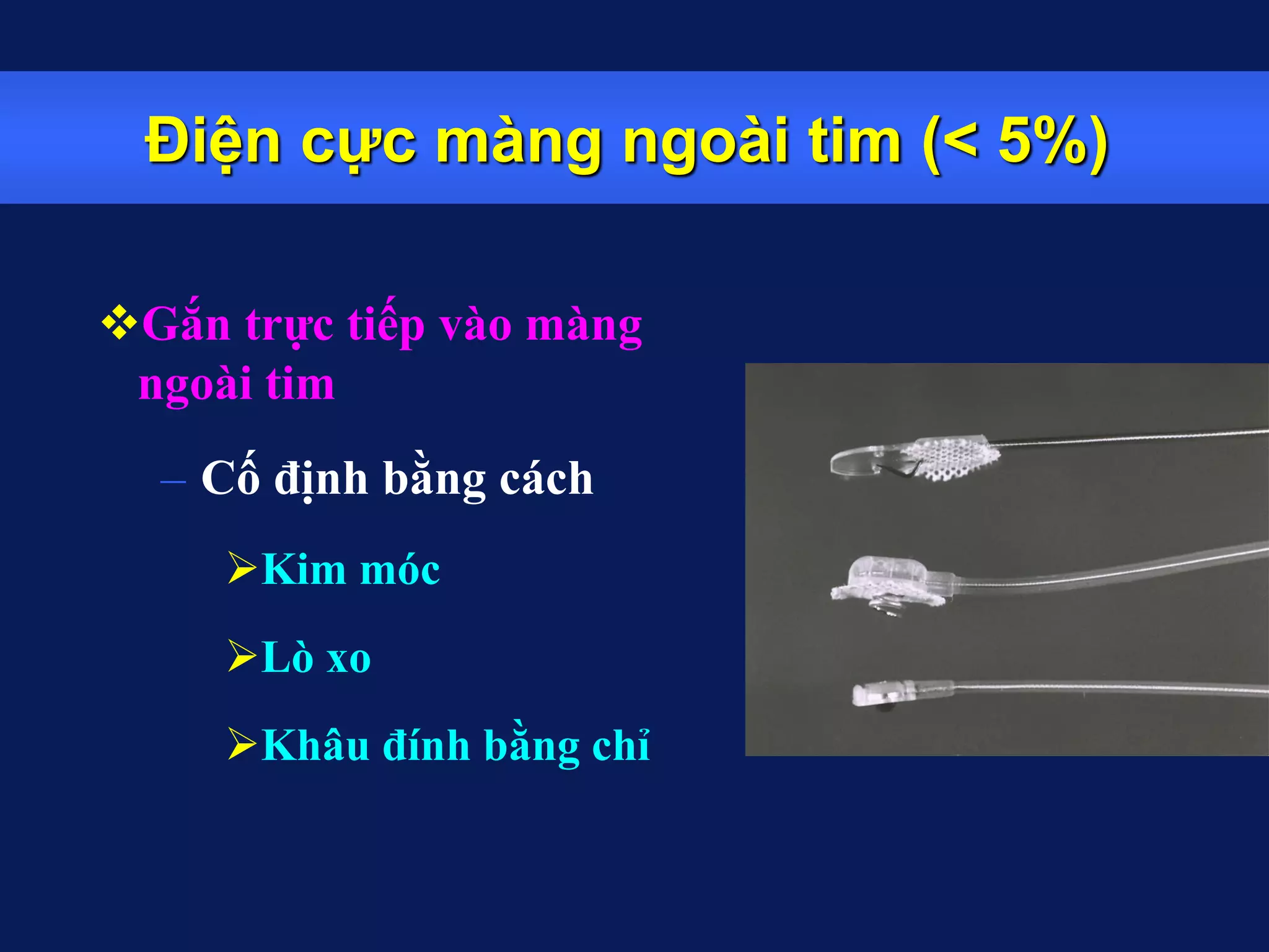 Cac khai niem co ban ve may tao nhip va cach nhan biet dien tam do may ...