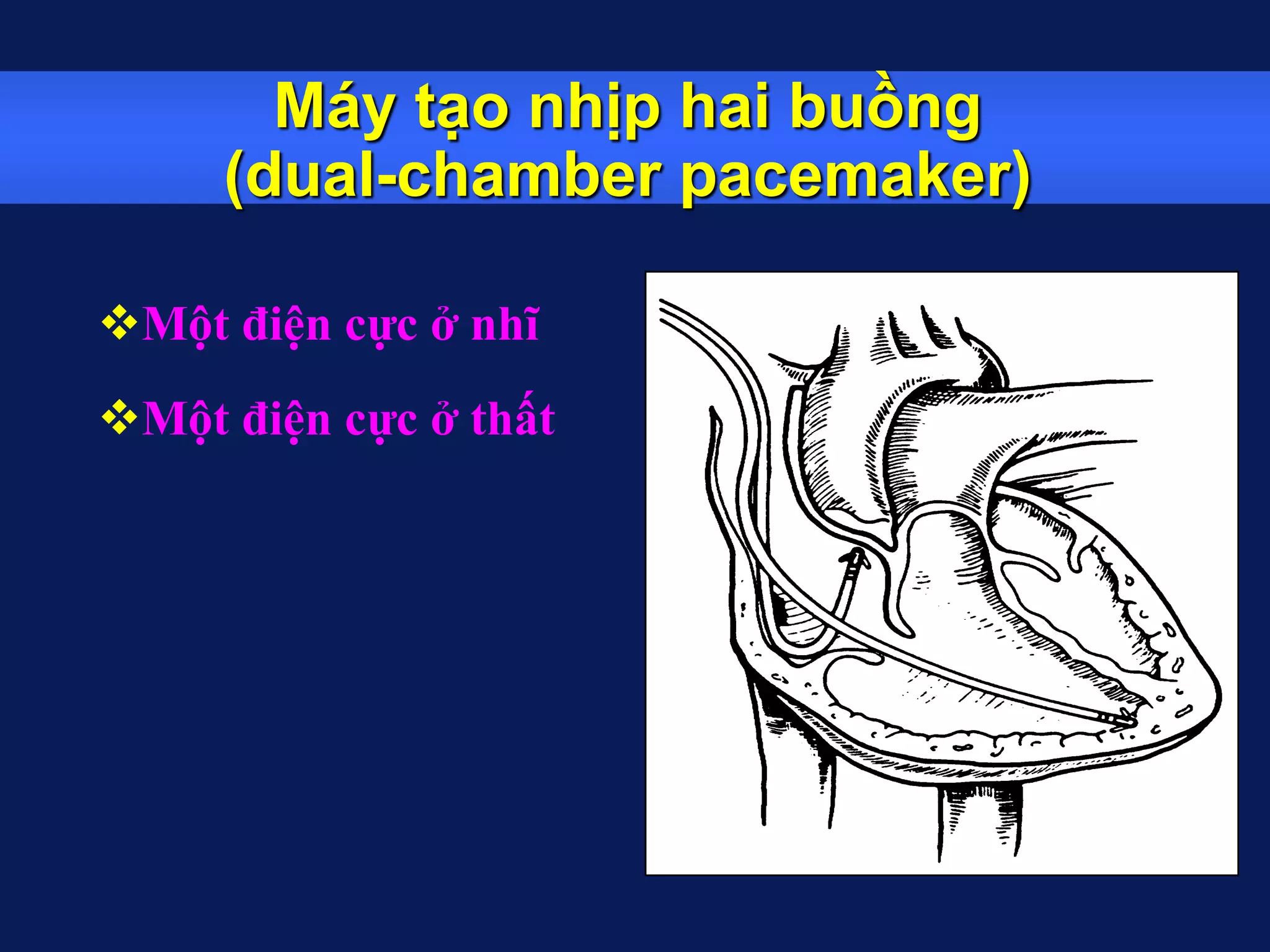 Cac khai niem co ban ve may tao nhip va cach nhan biet dien tam do may ...