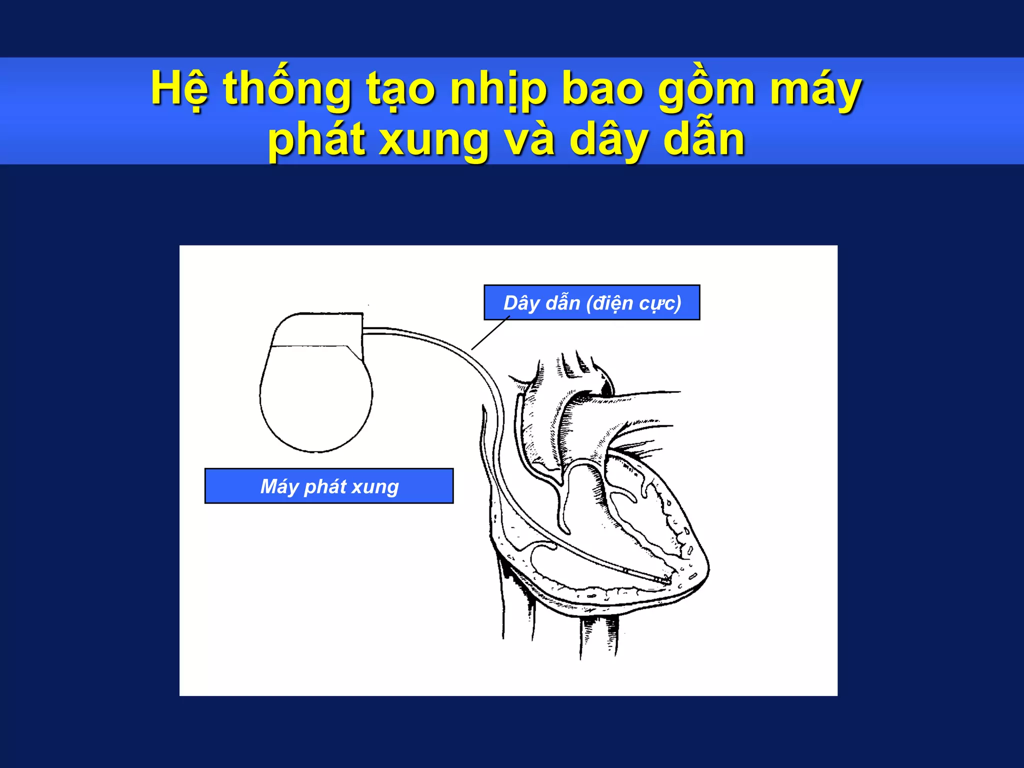 Cac khai niem co ban ve may tao nhip va cach nhan biet dien tam do may ...