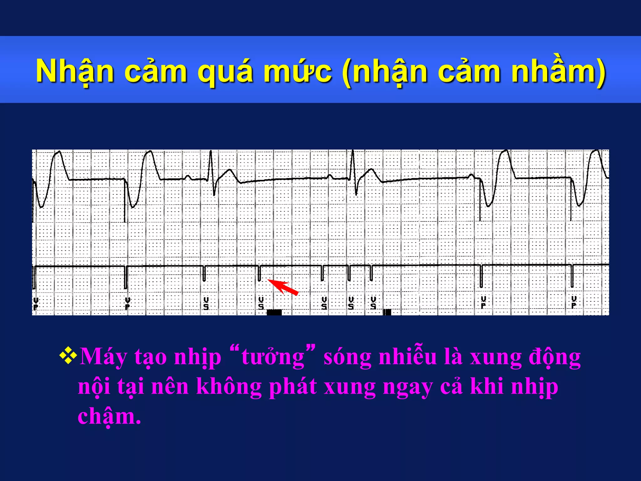 Cac khai niem co ban ve may tao nhip va cach nhan biet dien tam do may ...
