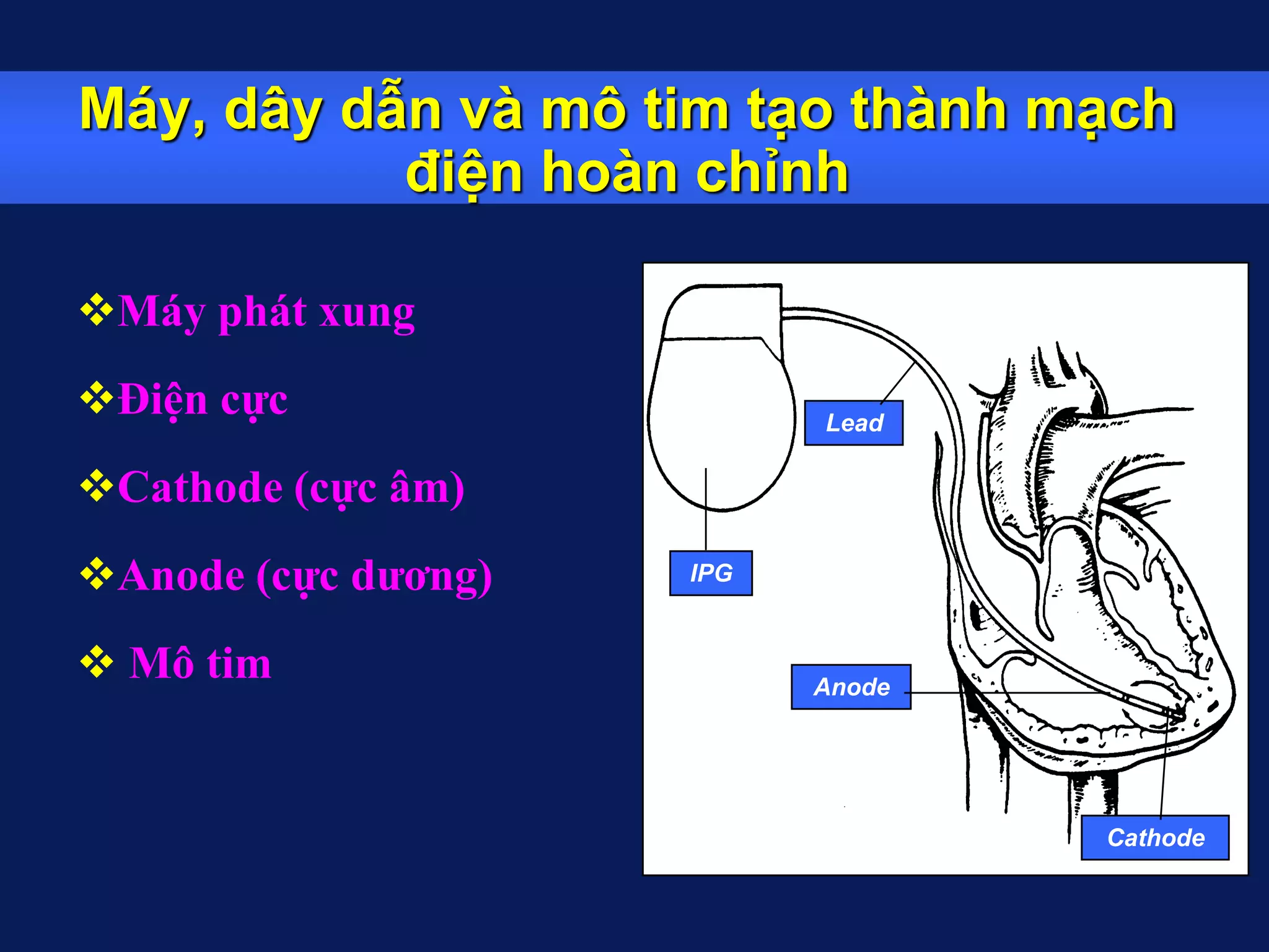 Cac khai niem co ban ve may tao nhip va cach nhan biet dien tam do may ...