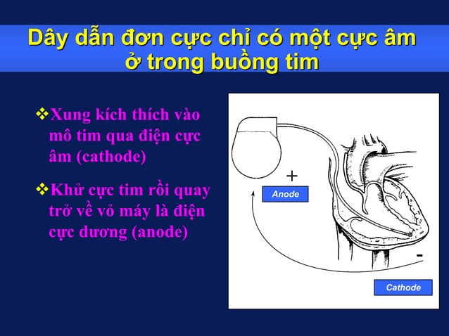 Cac khai niem co ban ve may tao nhip va cach nhan biet dien tam do may ...