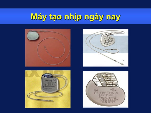 Cac khai niem co ban ve may tao nhip va cach nhan biet dien tam do may ...