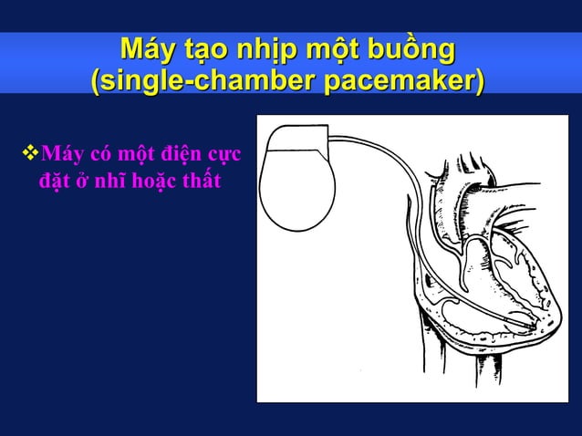 Cac khai niem co ban ve may tao nhip va cach nhan biet dien tam do may ...
