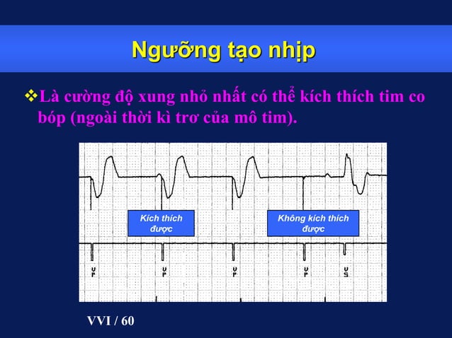 Cac khai niem co ban ve may tao nhip va cach nhan biet dien tam do may tao nhip | PDF