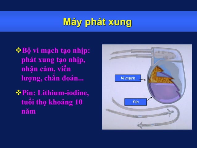 Cac khai niem co ban ve may tao nhip va cach nhan biet dien tam do may ...