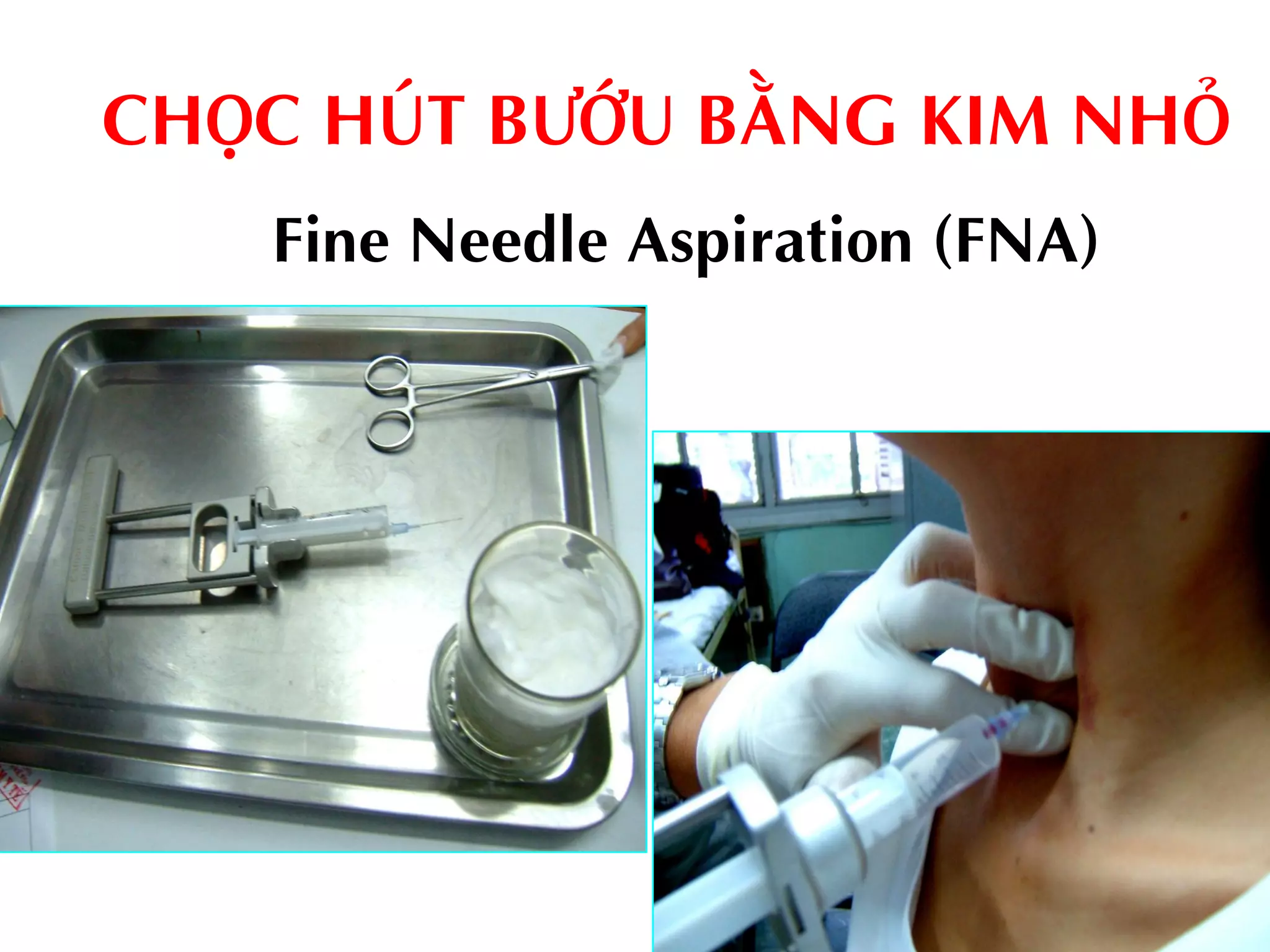 Cac ky thuat kham co ban | PDF