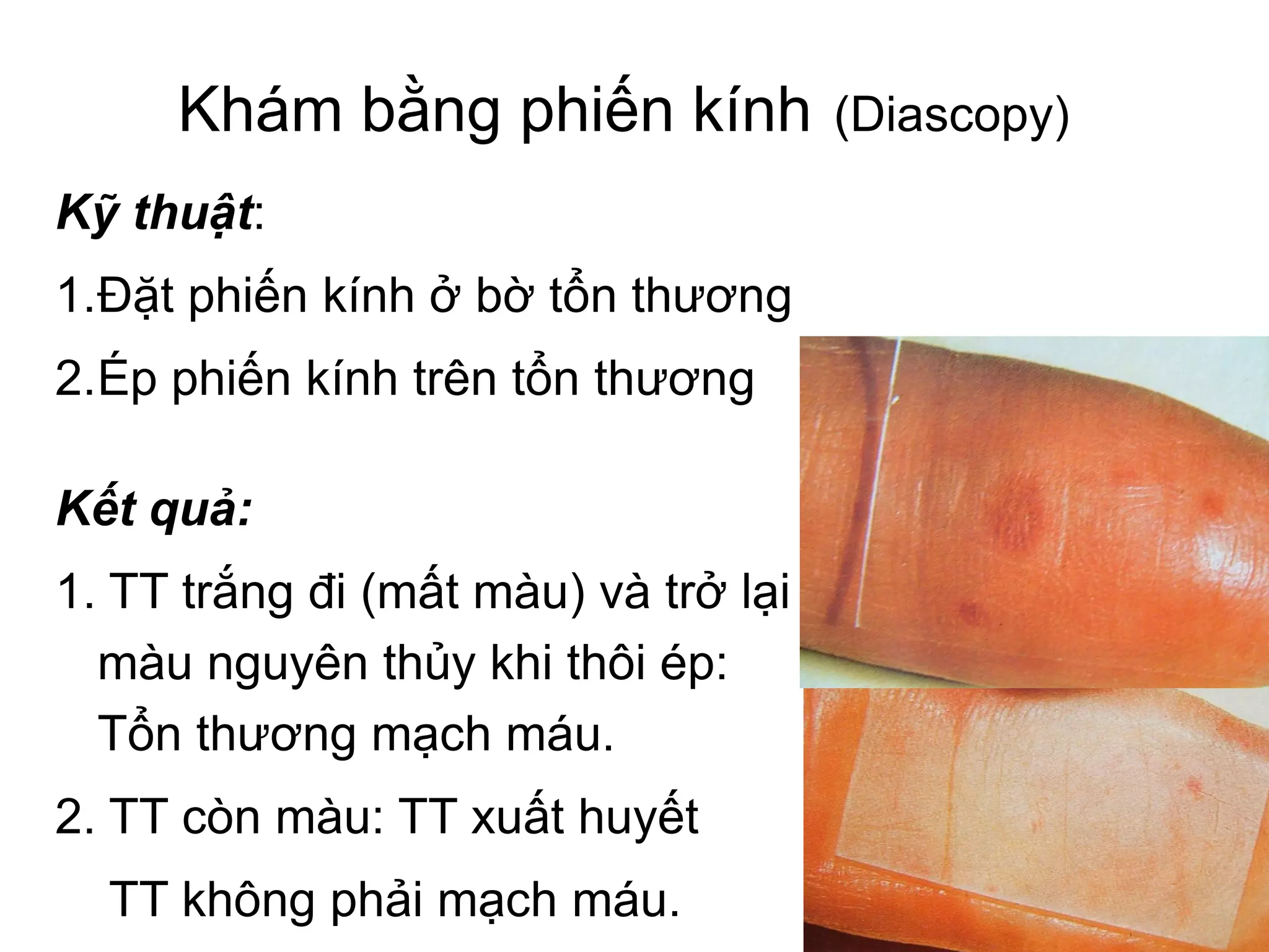 Cac ky thuat kham co ban | PDF