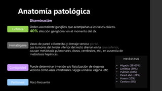 Cancer de colon | PPTX