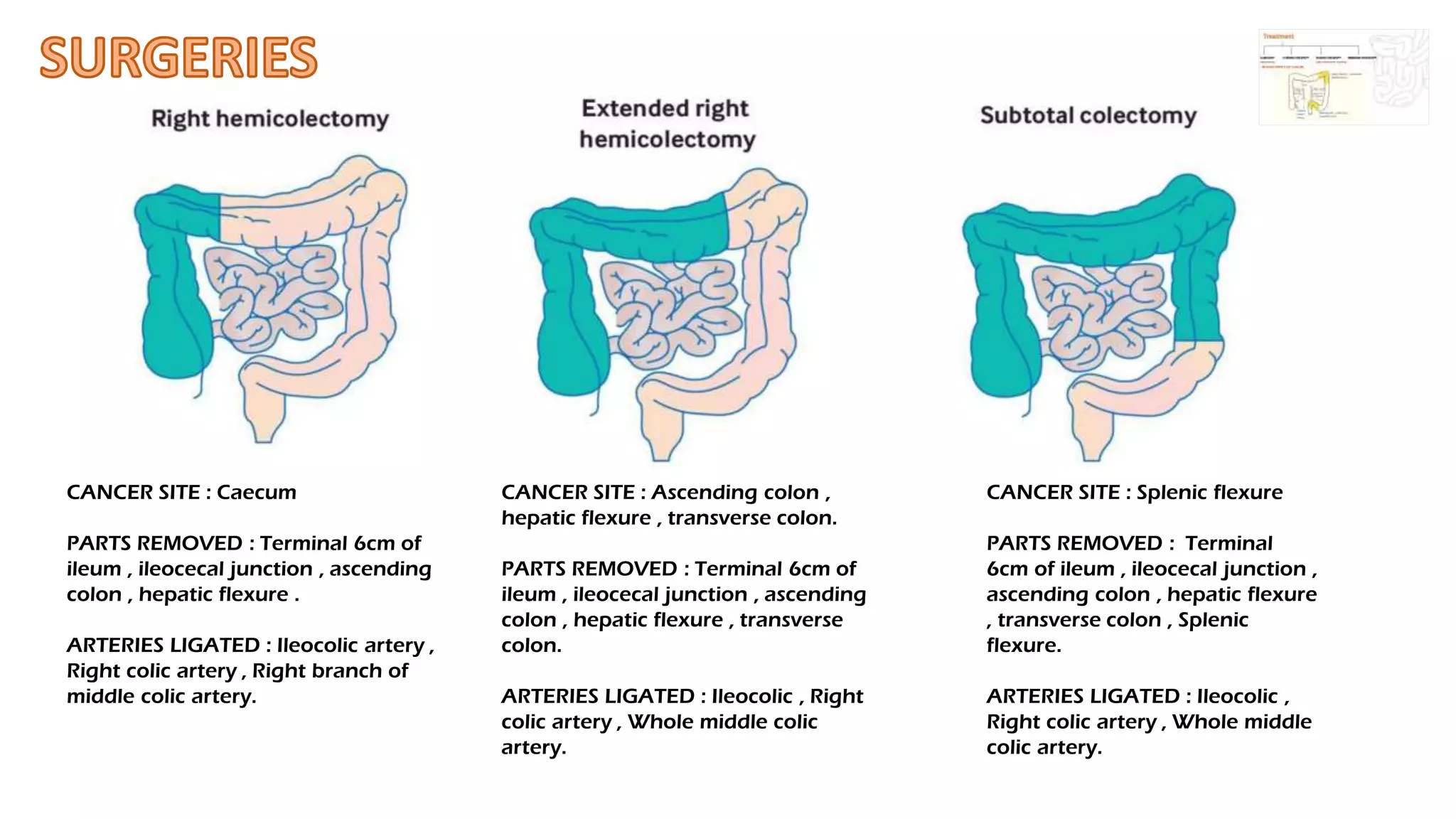 Carcinoma of colon and rectum for MBBS | PDF