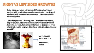 Carcinoma of colon and rectum for MBBS | PDF