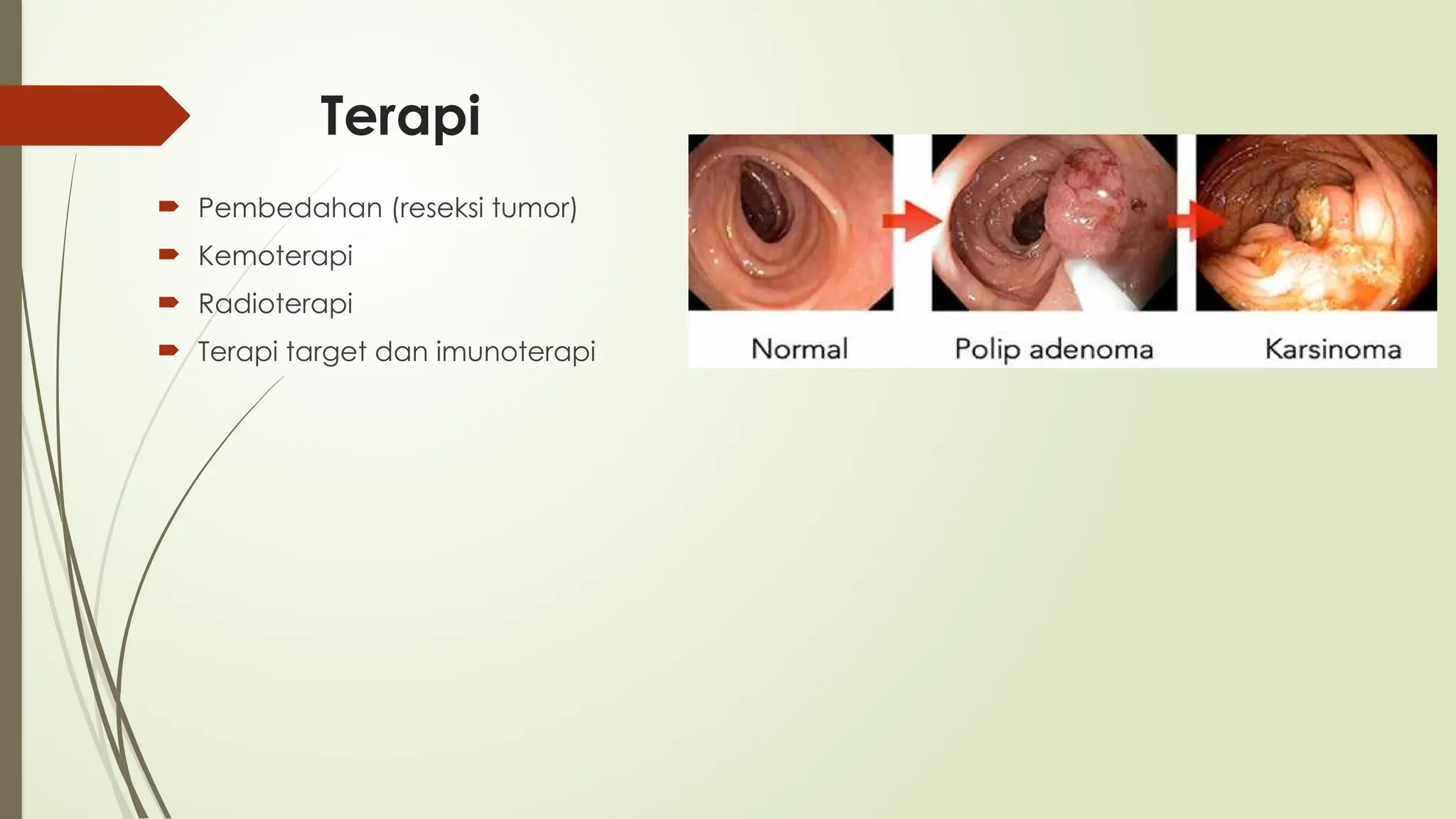 materi tentang kanker Colon dan Kanker Kolorektal | PPTX
