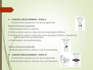 Cáncer Cervicouterino | PPTX