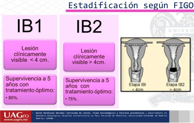 Cáncer Cervicouterino