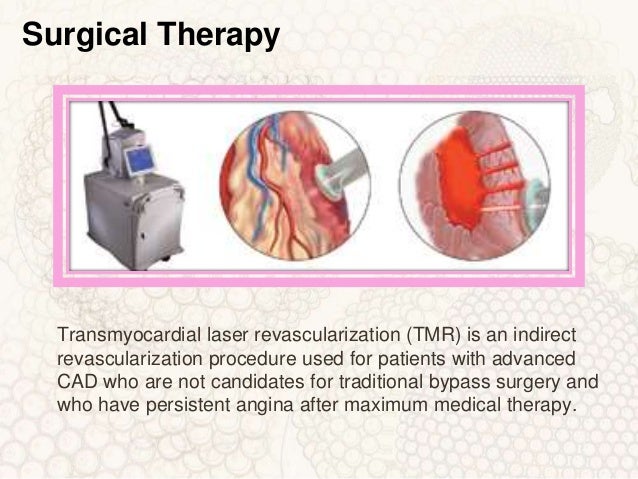 Coronary Artery Diseases (CAD)