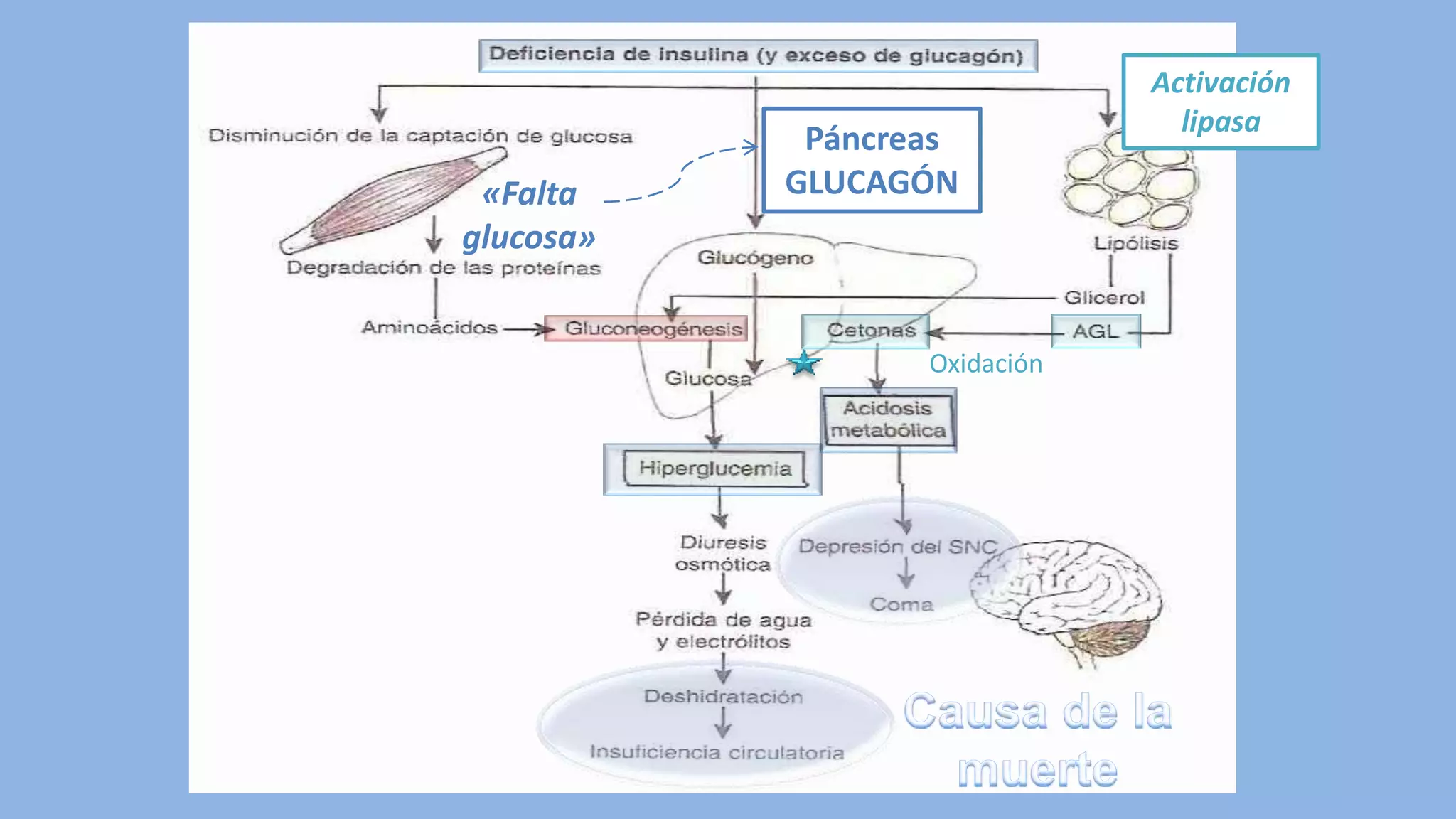 Cetoacidos Diabetica en Pediatria | PPTX | Diabetes | Diseases and ...