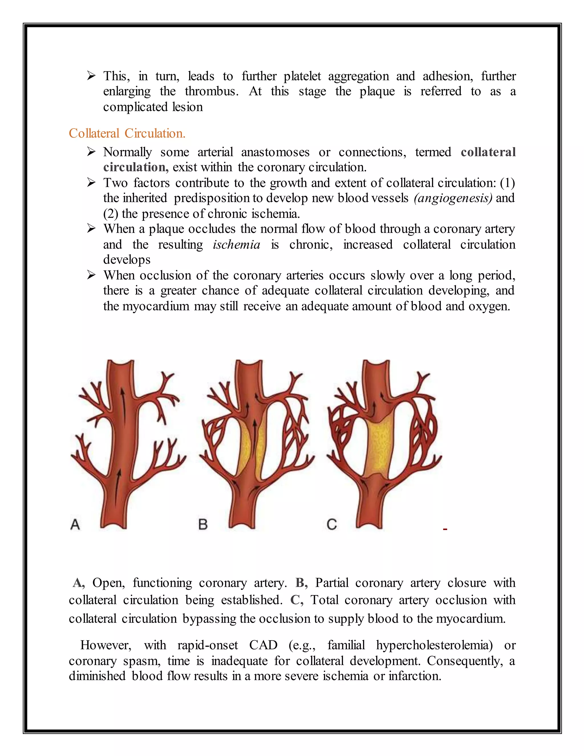 coronary artery disease | DOCX