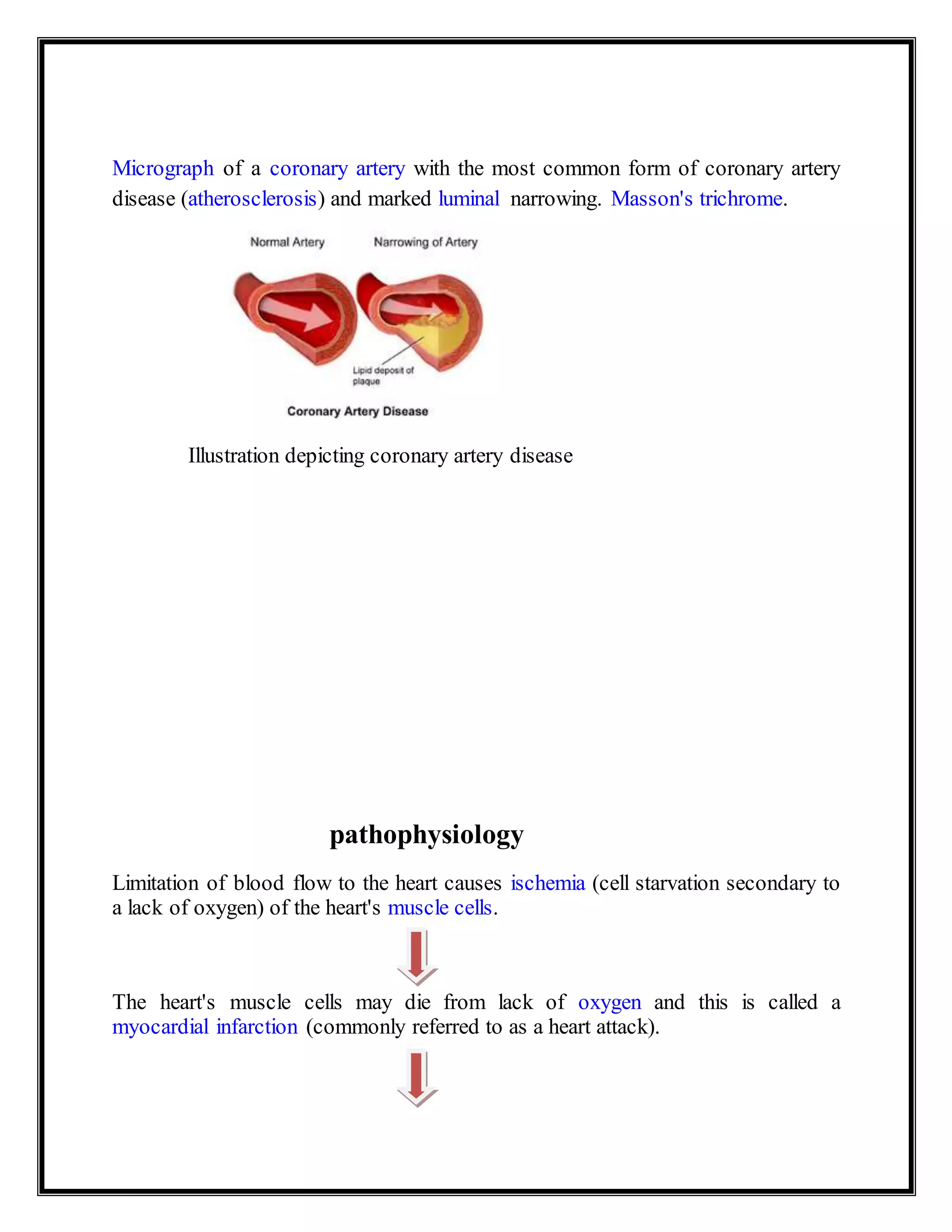 coronary artery disease | DOCX