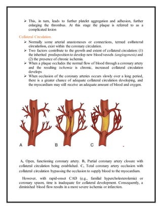 coronary artery disease | DOCX