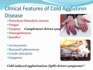 cold agglutinin disease in cardiac surgery | PPTX