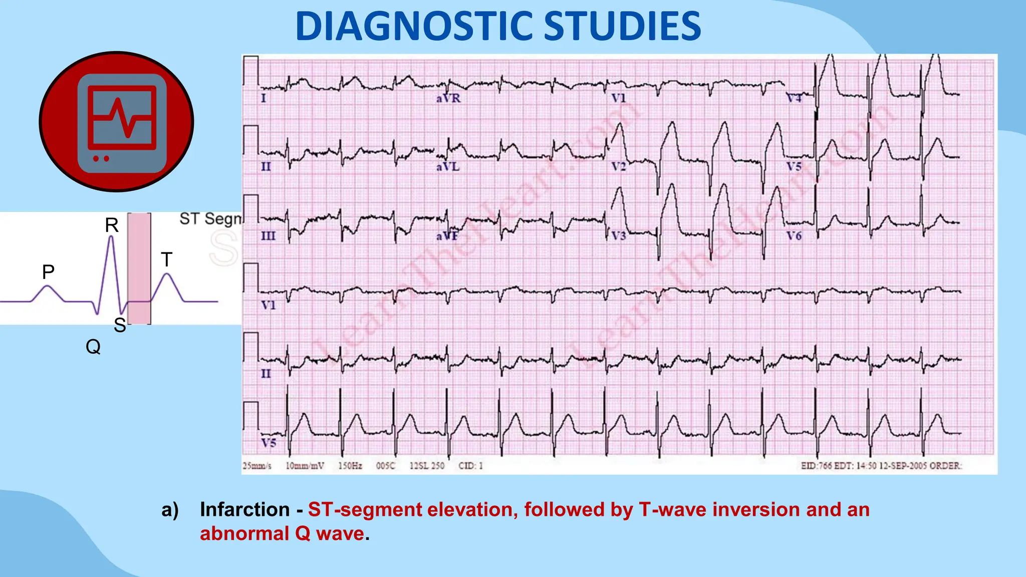 ADULT BLOOD CIRCULATION & CORONARY ARTERY DISEASE | PPT