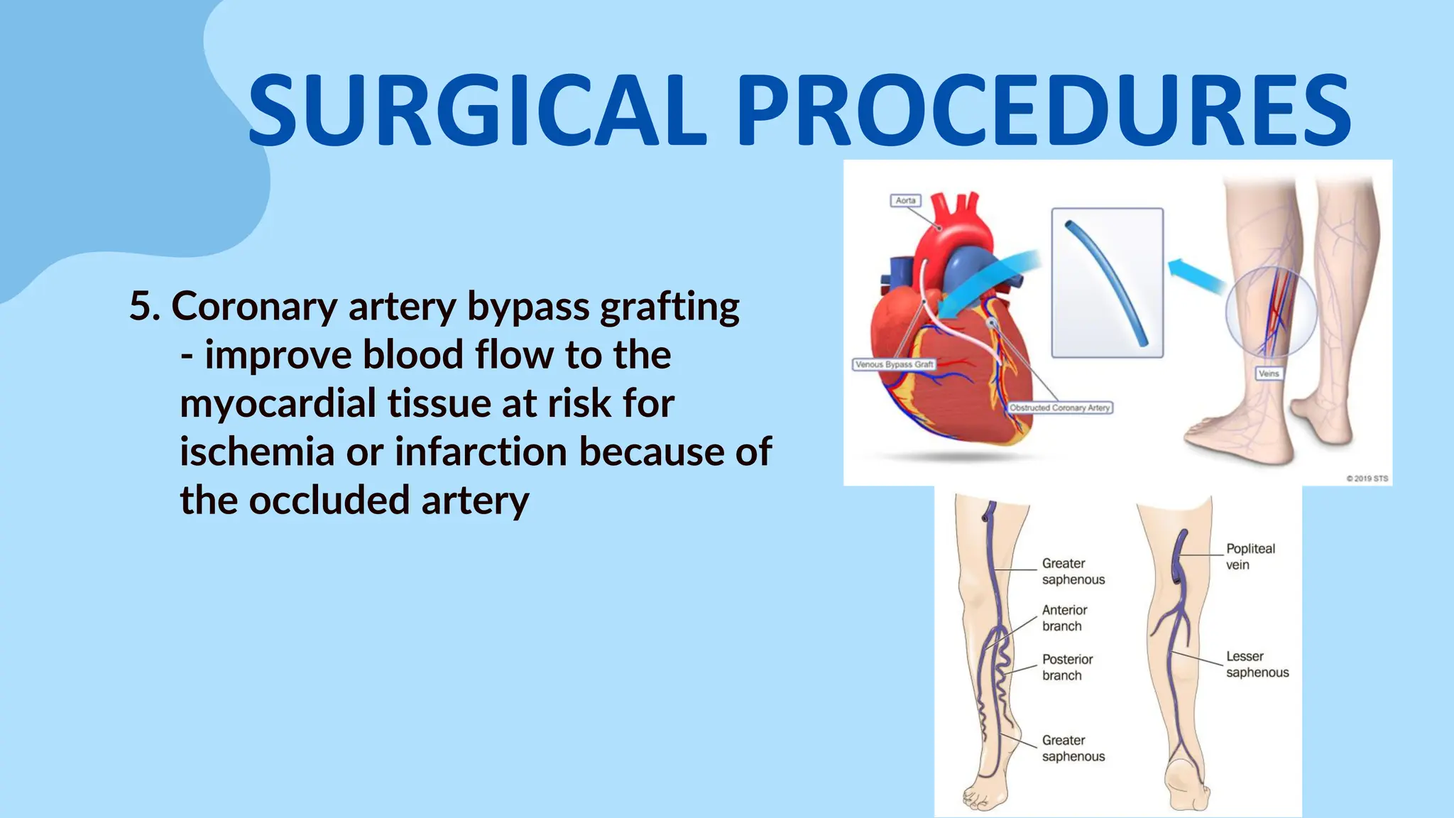ADULT BLOOD CIRCULATION & CORONARY ARTERY DISEASE | PPT